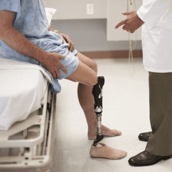 What Is Multiple Extremity Amputation? | Dubai Mobility